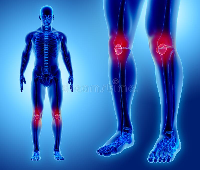 3D Ejemplo De La Rótula, Concepto Médico Stock de ilustración ...