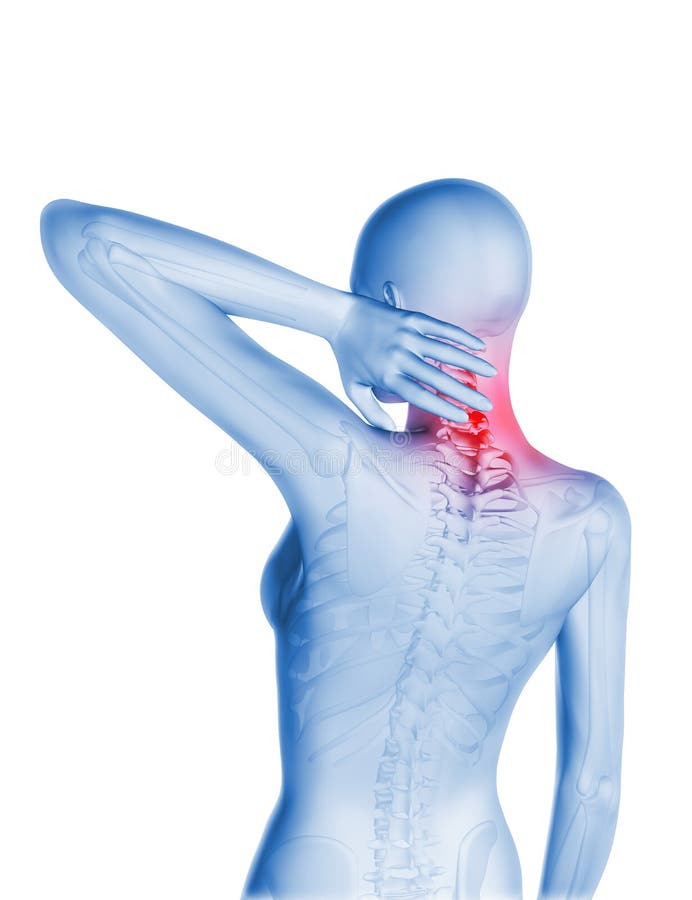3D Female Figure with Neck Pain Stock Illustration - Illustration of ...