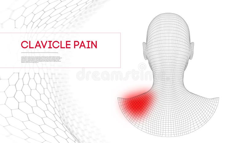 3D Human Head Model Highlighting Clavicle Pain Stock Vector ...