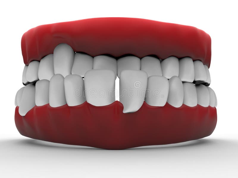 3D Illustration - Bad Teeth Stock Illustration - Illustration of render ...