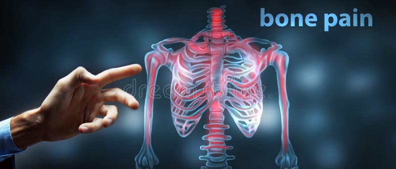 3d Illustration of Bone Pain, Examining Stock Image - Image of ...