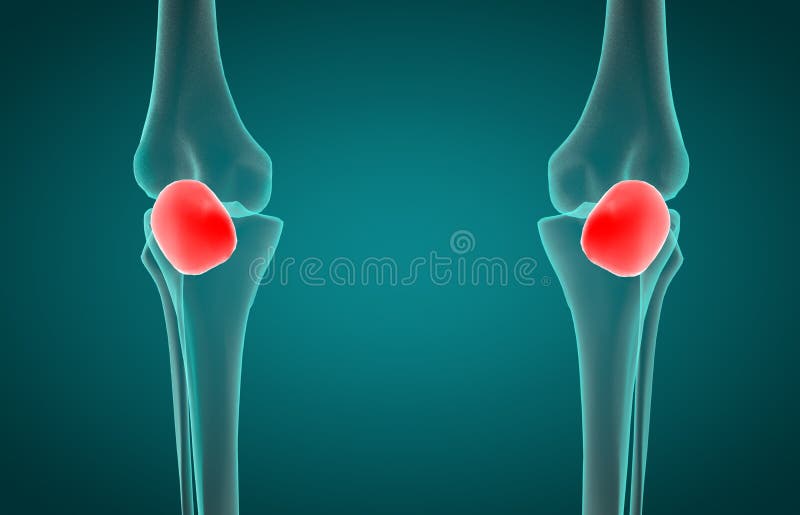 Illustration 3D De La Rotule - Une Partie De Squelette Humain ...