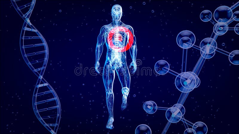3D Illustration of a Heart Attack Stock Illustration - Illustration of ...