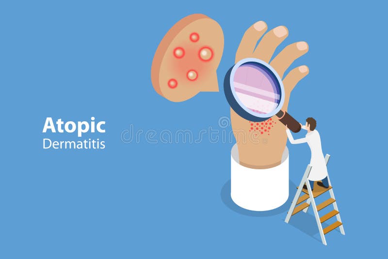 Atopic Dermatitis Care Stock Illustrations – 411 Atopic Dermatitis Care ...