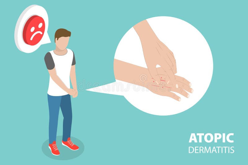 Atopic Dermatitis Care Stock Illustrations – 331 Atopic Dermatitis Care ...