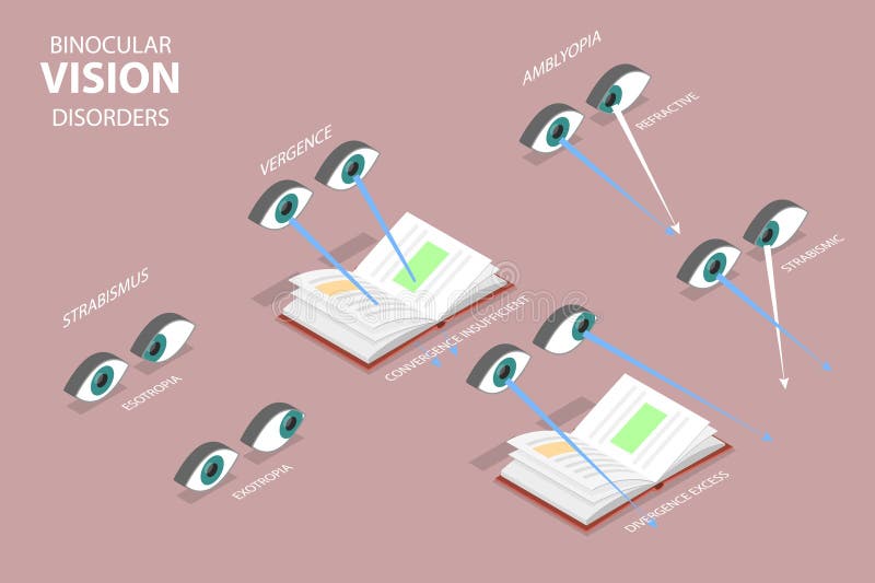 3D Isometric Flat Vector Conceptual Illustration of Binocular Vision ...