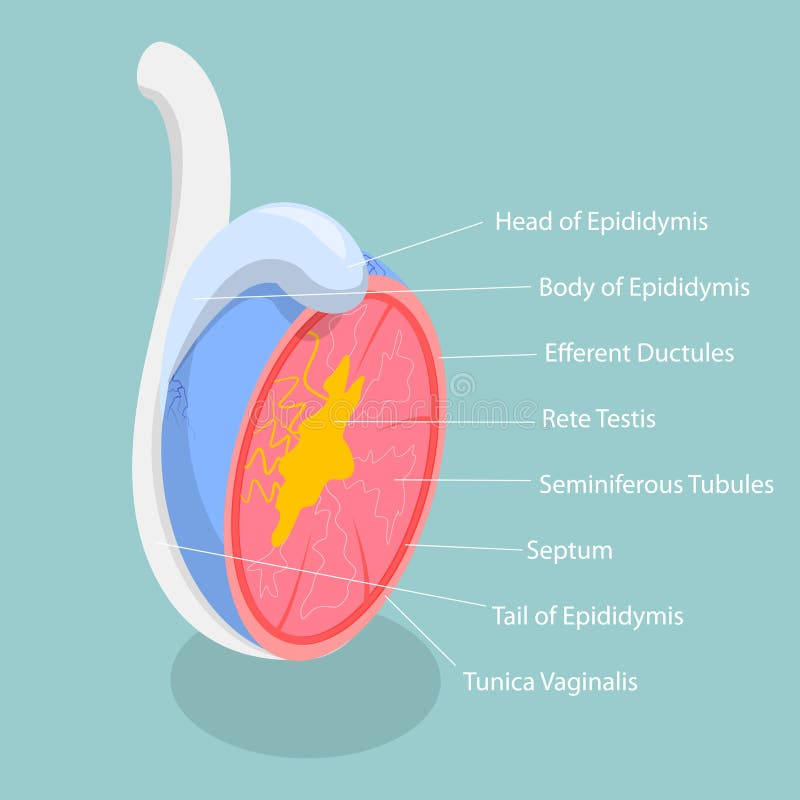 Varicocele Ligation Stock Illustrations – 24 Varicocele Ligation Stock ...