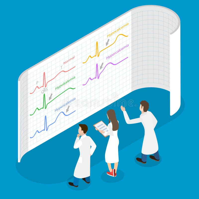 3D Isometric Flat Vector Illustration of ECG Changes Stock Vector ...