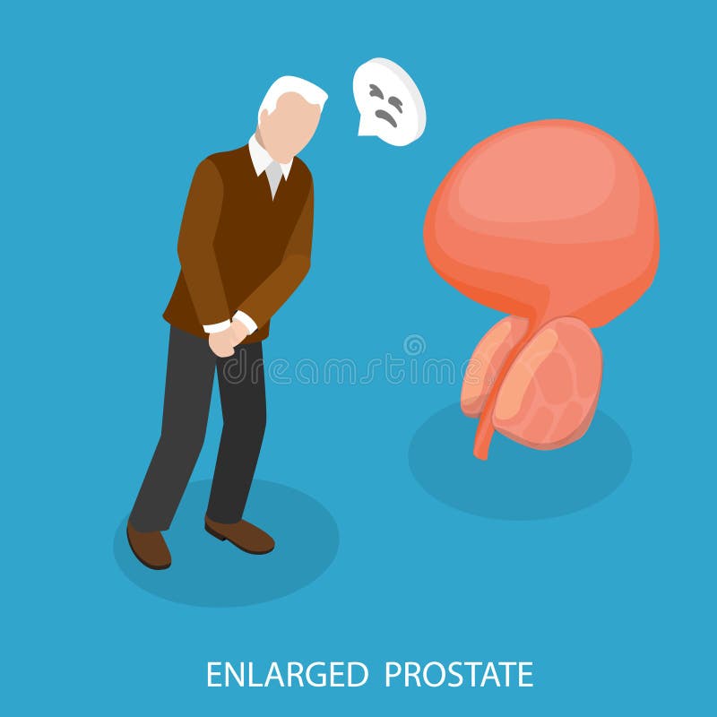 3D Isometric Flat Vector Illustration of Enlarged Prostate Stock Vector ...