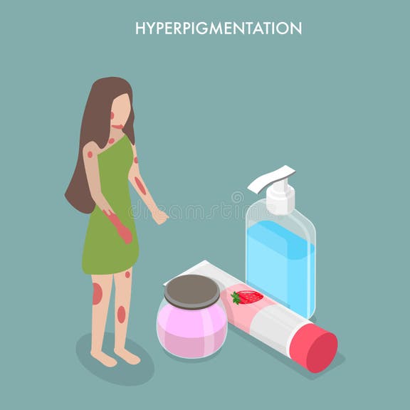 3D Isometric Flat Vector Illustration of Hyperpigmentation Stock Vector ...