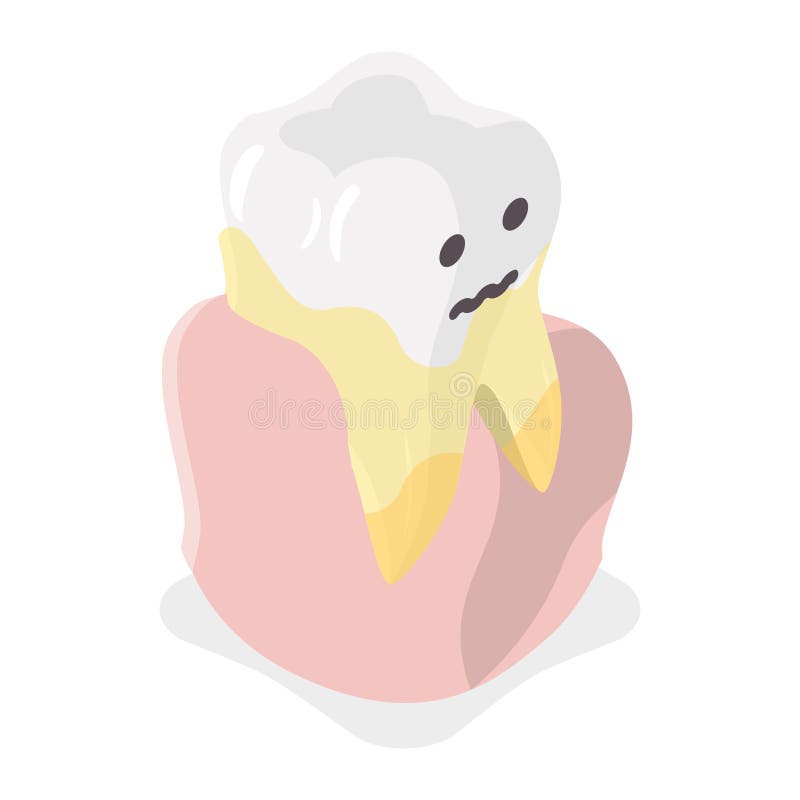 3D Isometric Flat Vector Illustration of Tooth Decay. Item 1 Stock ...
