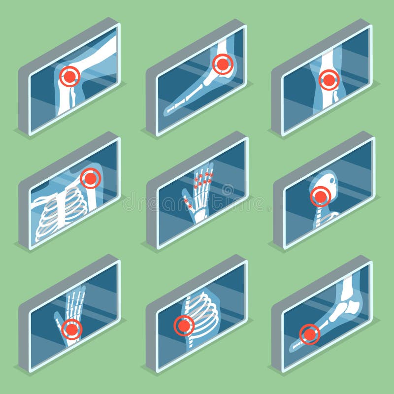 3D Isometric Flat Vector Set of Images of Human Joints Stock Vector ...