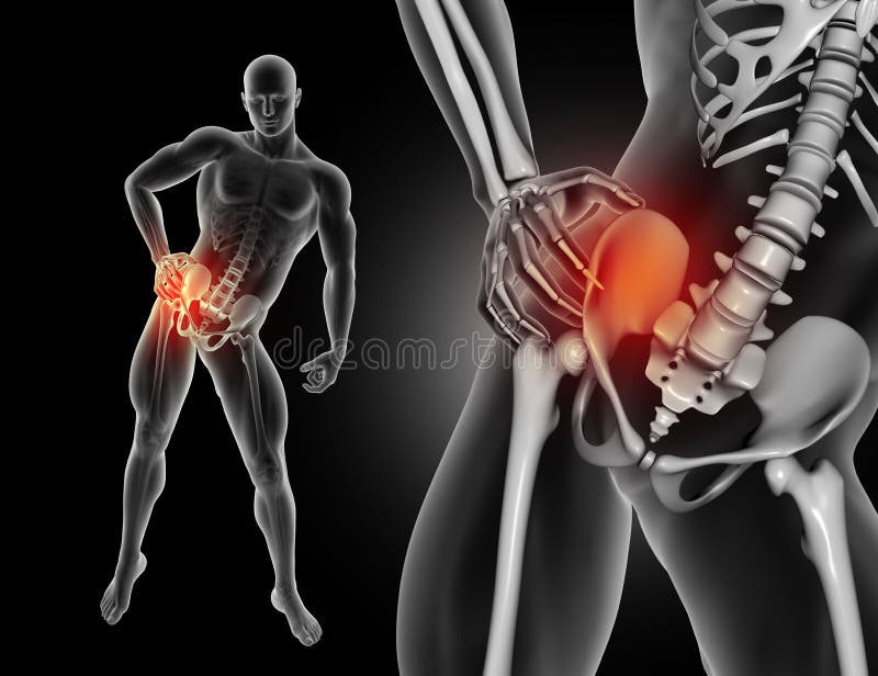 3D Male Figure Holding Hip in Pain with Close Up of Hip Bone Stock ...