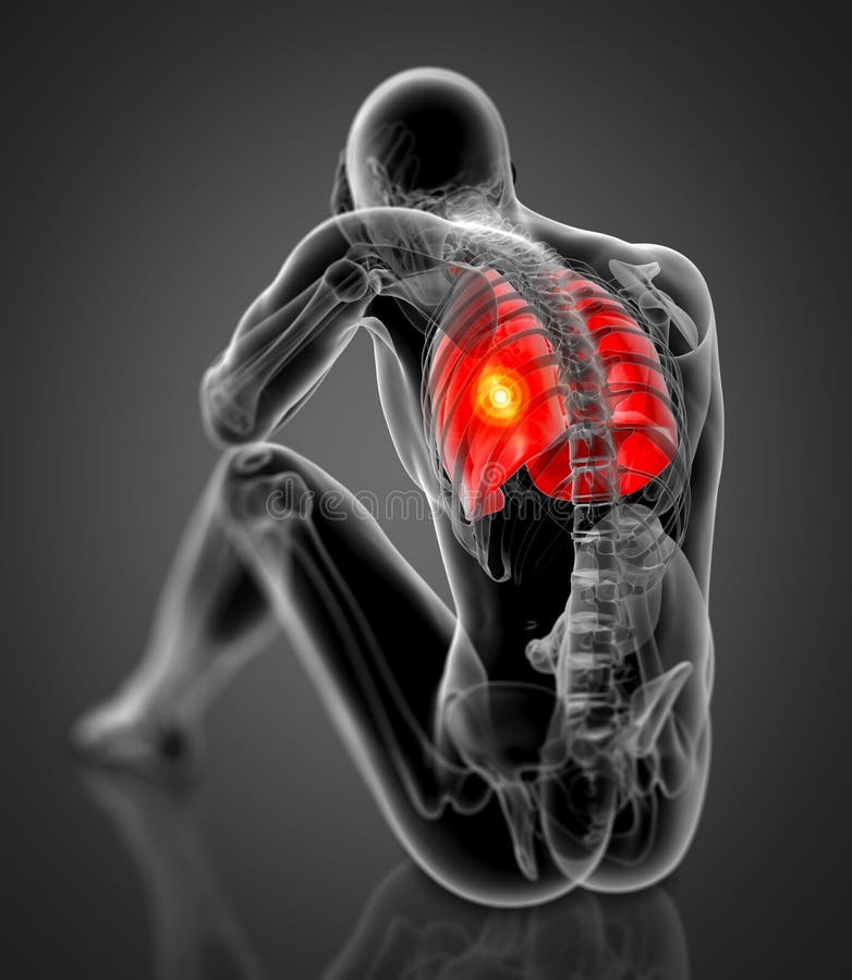 3D Rendering Illustration of Lung Stock Illustration - Illustration of ...