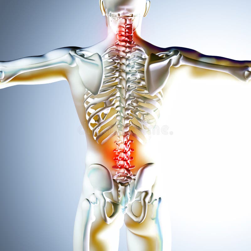 3d Medical Illustration Showing Back Pain Stock Illustration ...