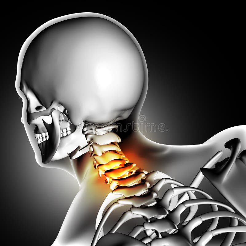 3D Medical Image of Neck Bone Stock Illustration - Illustration of ...