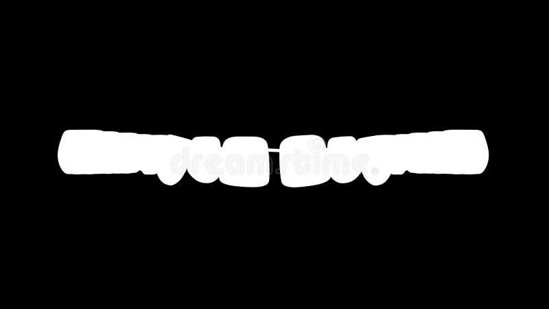Lingual Braces System. 3D Animation Concept of Golden Braces Stock ...
