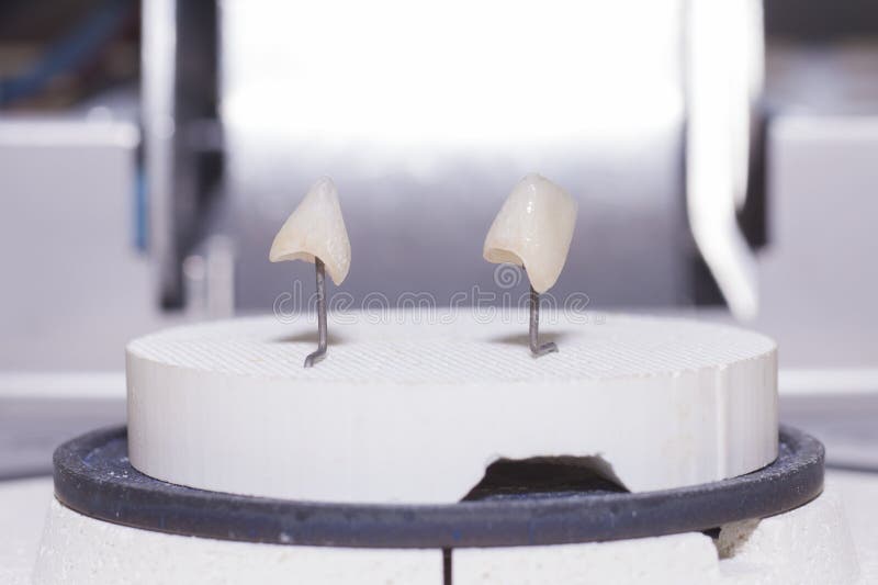 3d Printed Teeth Heated at Machine Stock Photo - Image of compound ...