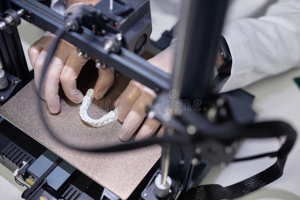 3D Printer Engineer Taking Created Dental Sample Stock Image - Image of stem, hand: 304844481