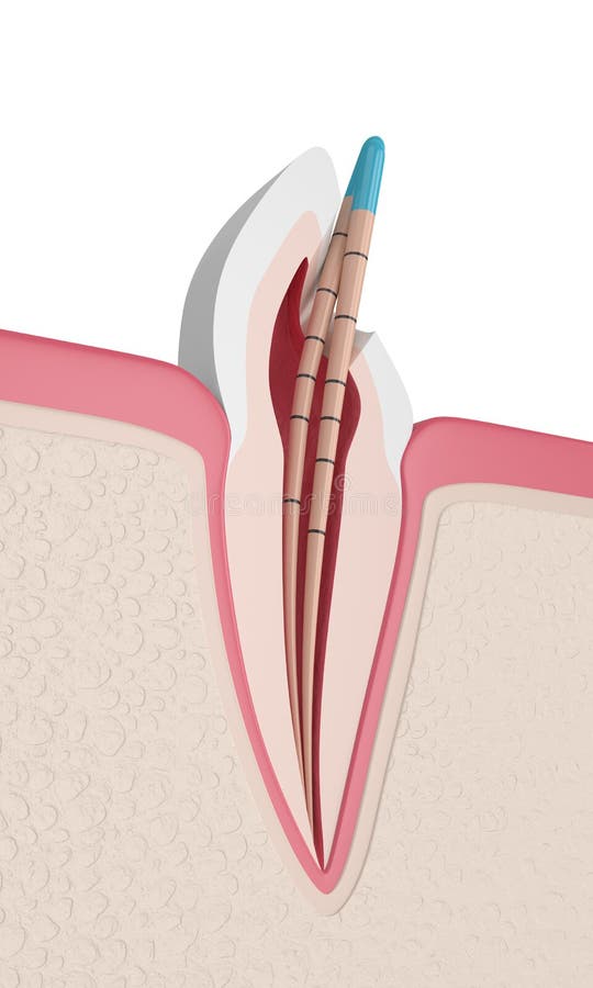 Incisive Stock Illustrations, Vecteurs, & Clipart – (1,057 Stock ...