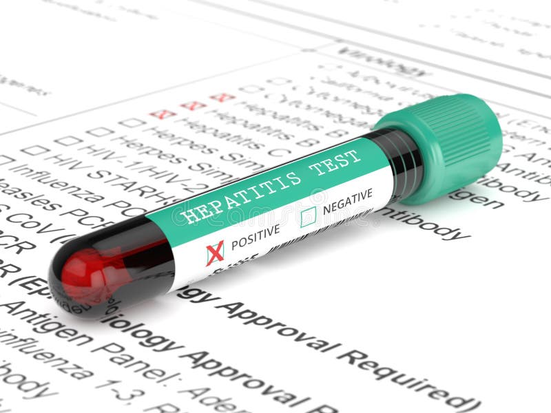 3d Render of Blood Samples with Hepatitis Test Stock Illustration ...