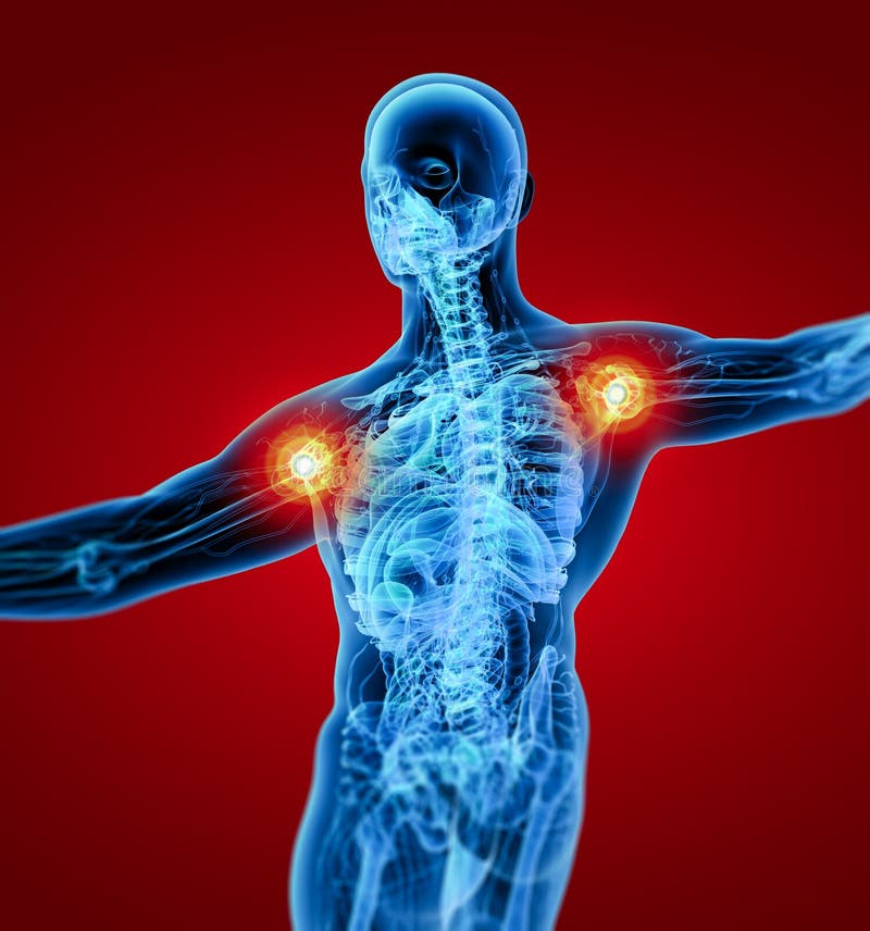 3D Rendering Illustration of Lymphatic System Stock Illustration ...