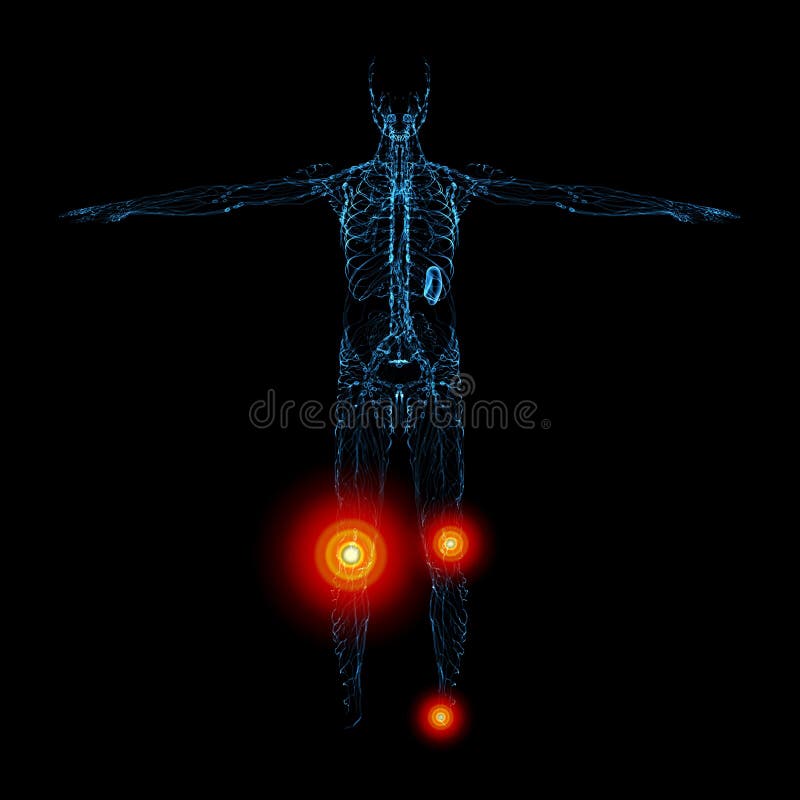 3D Rendering Illustration of Lymphatic System Stock Illustration ...