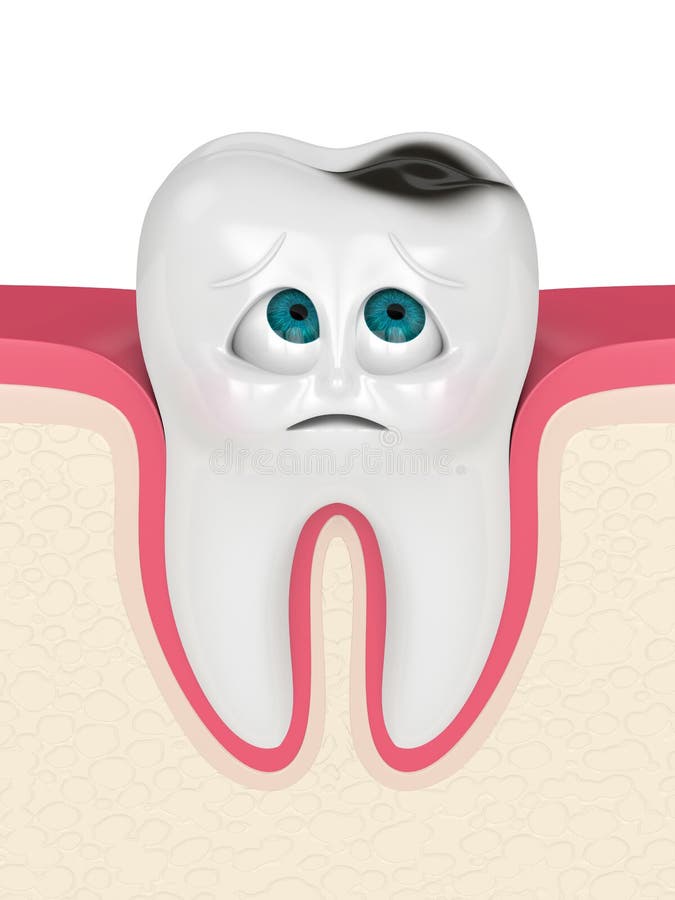 3D Render of Cartoon Mr Tooth in Gums Looking at Cavity Stock ...