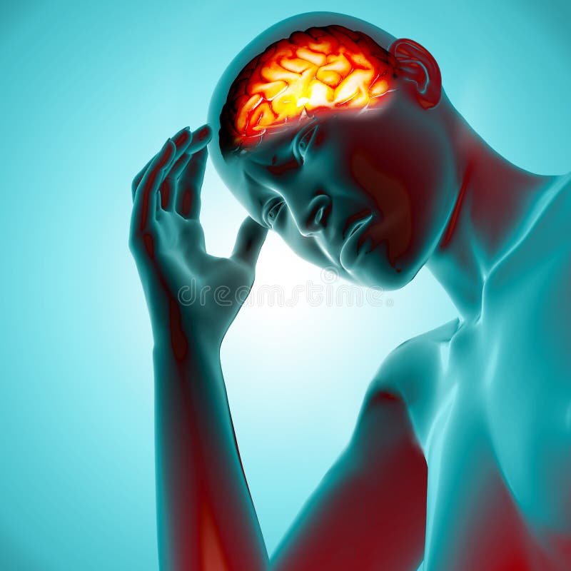 3D Render Of A Female With Pain In Head Stock Illustration ...