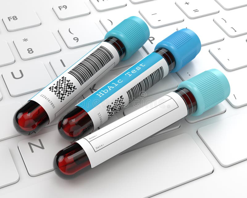 3d Render of HbA1c Blood Tubes Lying on Computer Keyboard Stock ...