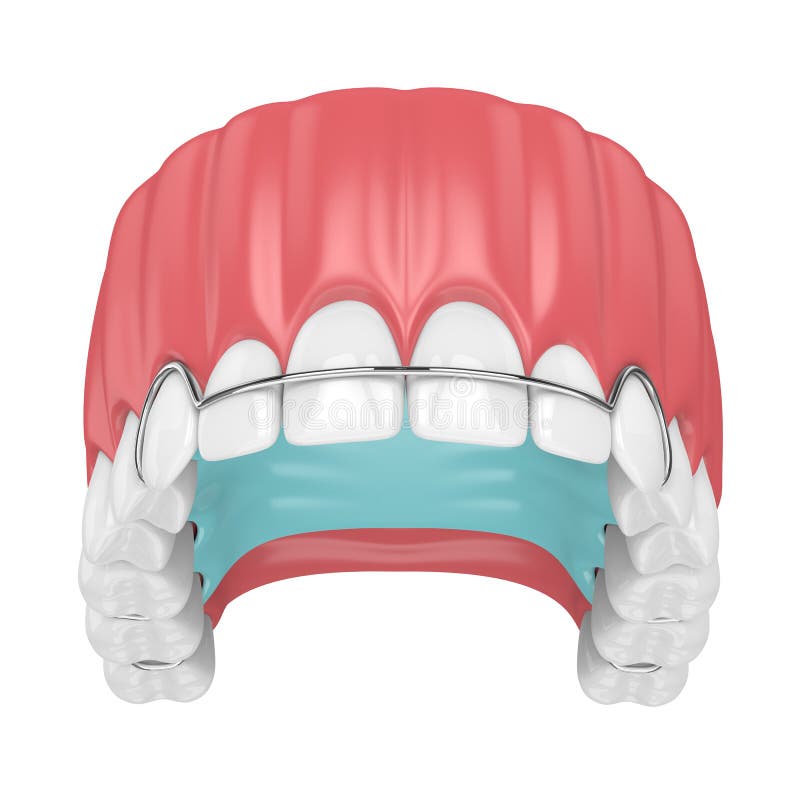 Orthodontic Stock Illustrations – 14,050 Orthodontic Stock ...