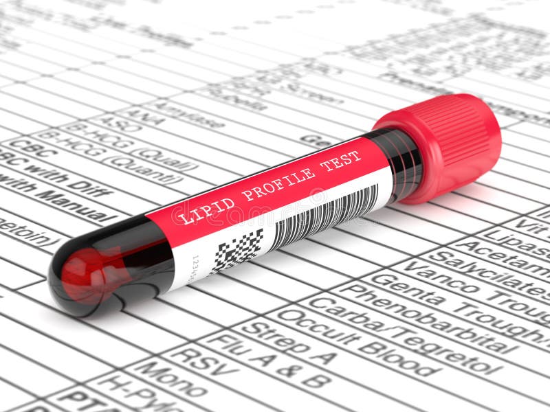 Lipid Profile Blood Test Lab Results Stock Vector - Illustration of ...