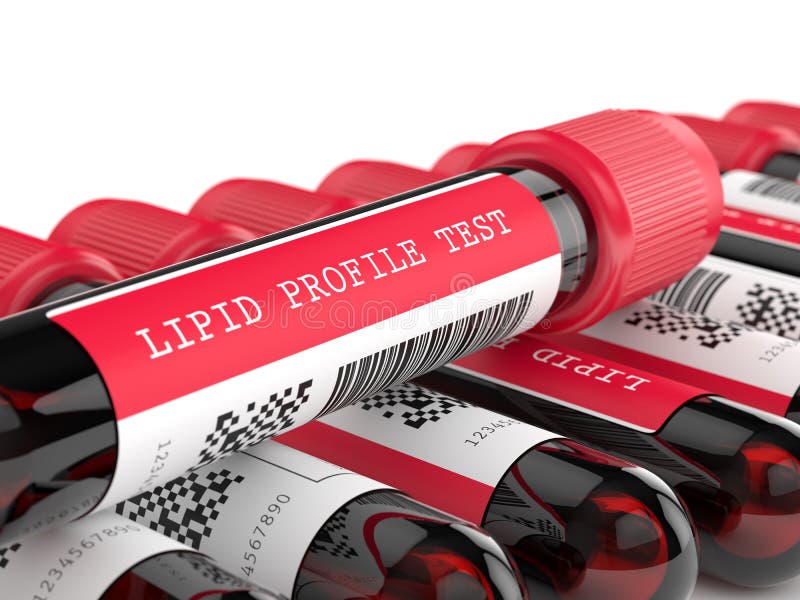 3d Render with Lipid Profile Test Blood Samples Stock Illustration ...