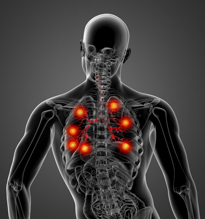 Lungs with visible bronchi stock illustration. Illustration of larynx ...