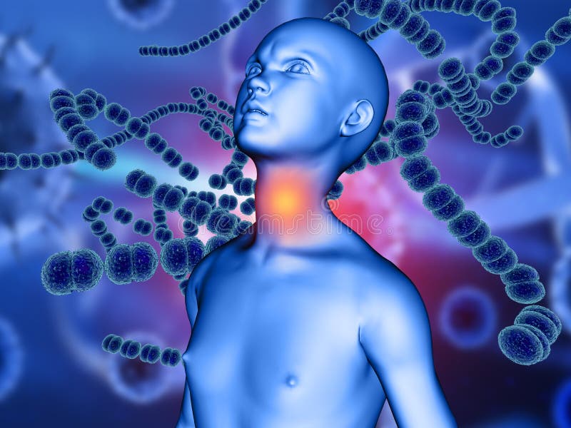 3D Medical Image Depicting a Child with the Strep a Virus Stock ...