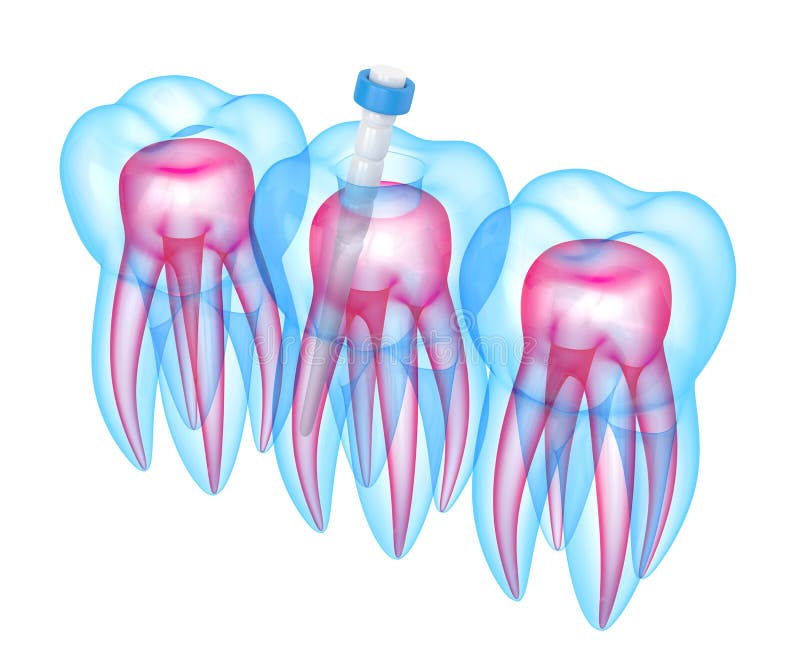 Pile White Teeth Stock Illustrations – 170 Pile White Teeth Stock ...