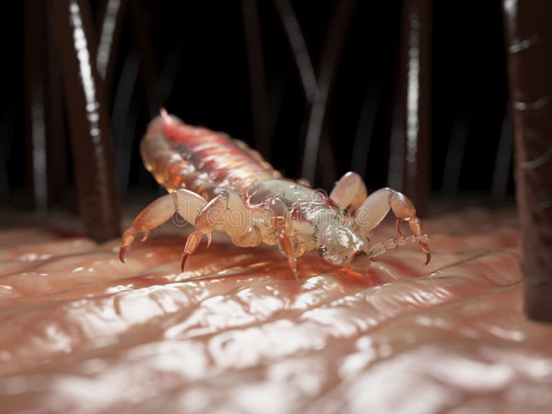 Head louse stock vector. Illustration of shaft, skin - 12907656