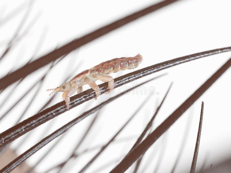 A head louse stock illustration. Illustration of macro - 139873992