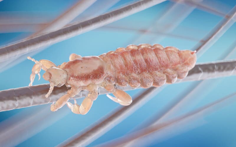 A head louse stock illustration. Illustration of hatching - 165074628