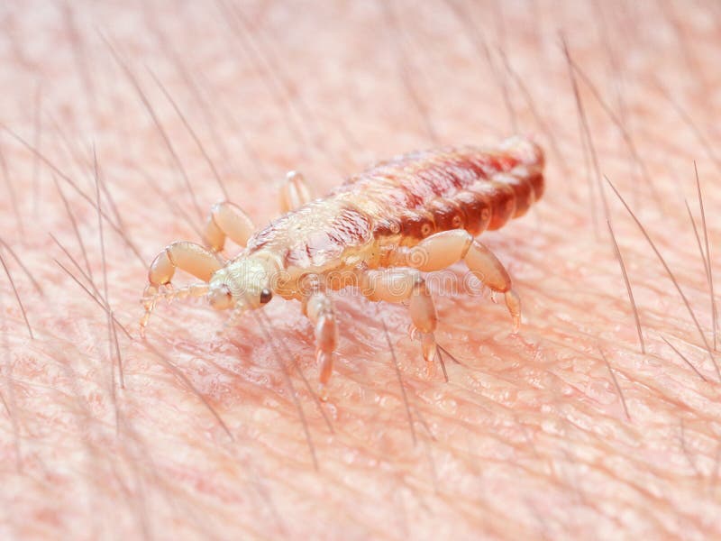 Head Louse Pediculus Humanus Capitis Under Microscope Stock Photo ...