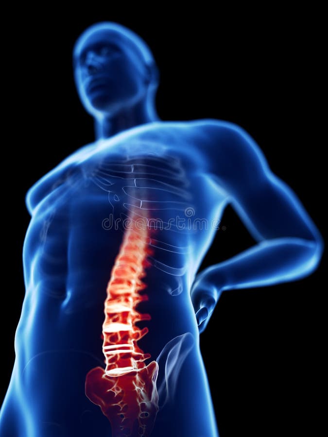 A man having backache stock illustration. Illustration of arthrosis ...