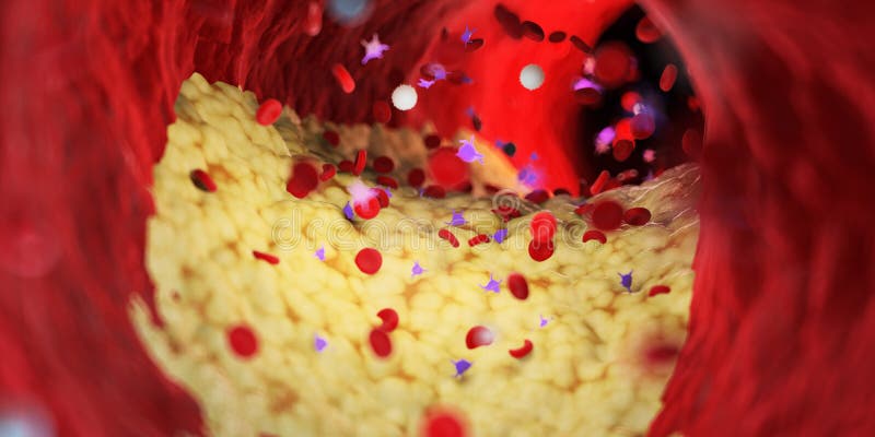 A capped plaque stock illustration. Illustration of blocked - 152237547