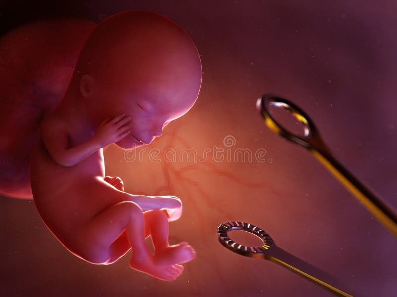 Abortion Stock Illustrations – 3,301 Abortion Stock Illustrations ...