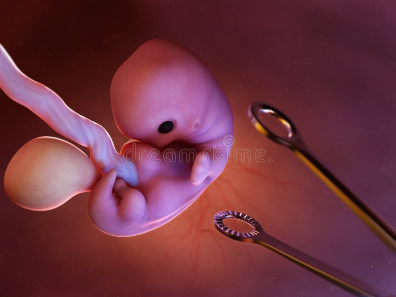 Abortion Stock Illustrations – 1,861 Abortion Stock Illustrations ...