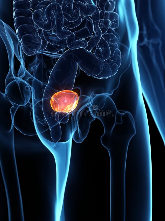 A diseased bladder stock illustration. Illustration of internal - 142497343