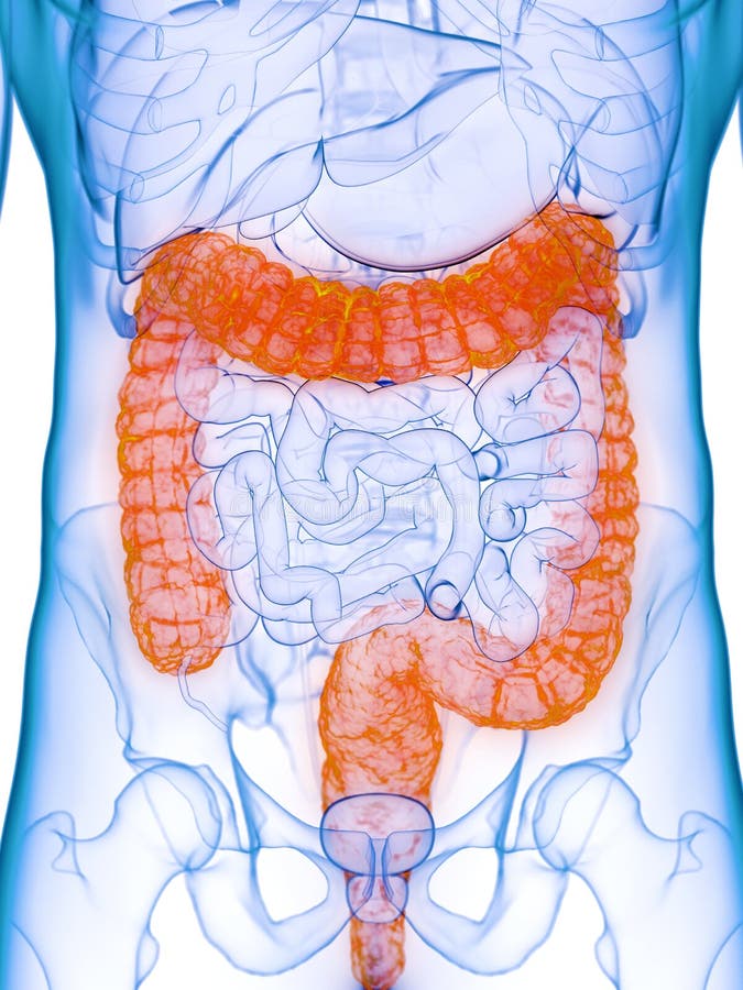 A diseased colon stock illustration. Illustration of blue - 144933033
