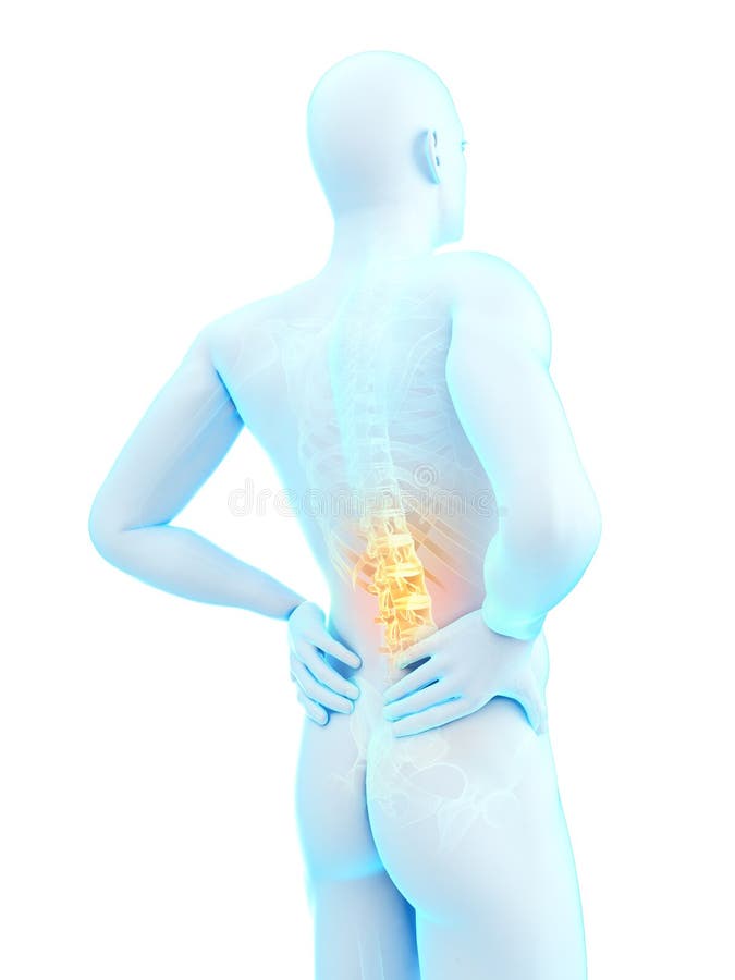 Backache illustration stock illustration. Illustration of cramp - 74819537