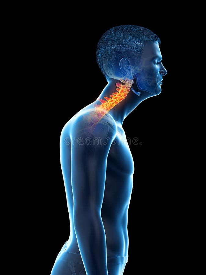A forward head posture stock illustration. Illustration of infection ...