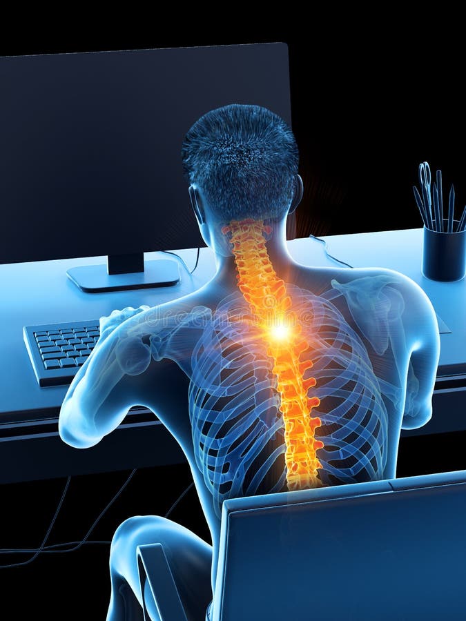 A man having a backache stock illustration. Illustration of disease ...