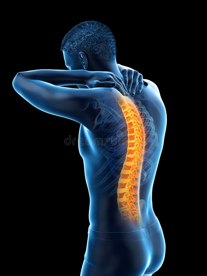 A painful upper back stock illustration. Illustration of rheumatism ...